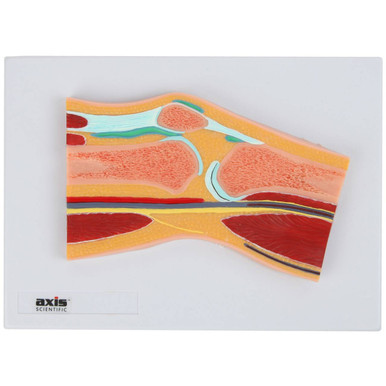 Axis Scientific Knee Joint Section Anatomy Model | Anatomy Warehouse