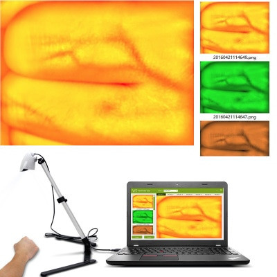 New Version Adjustable Adult Children Vein Viewer Display Infrare ...