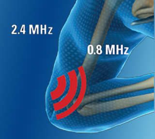 Soleo Sono Ultrasound | Zimmer MedizinSystems
