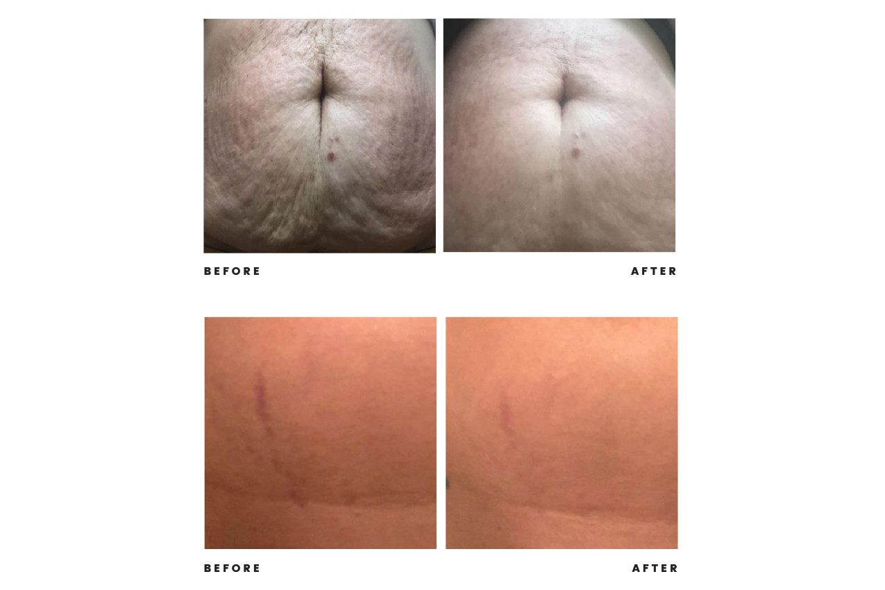 ReTone - Exfoliating Body Cleanser - Beauty Bridge