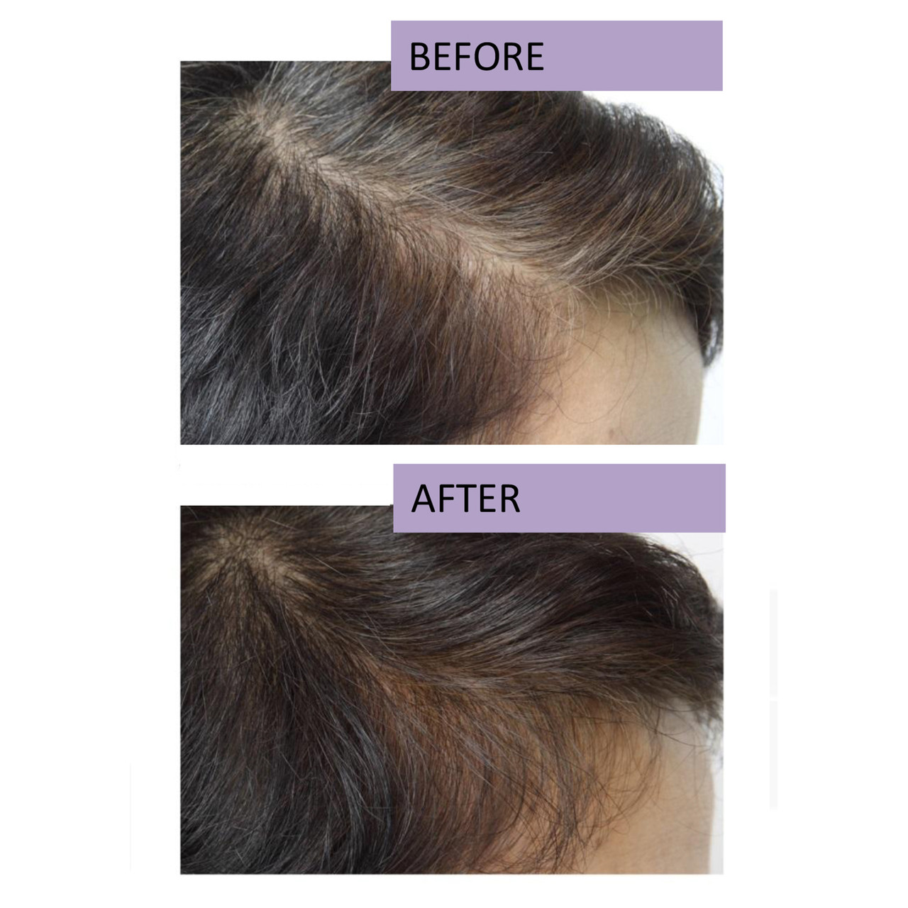 RapidLash - RapidHair Hair Volumizing Formula - Beauty Bridge