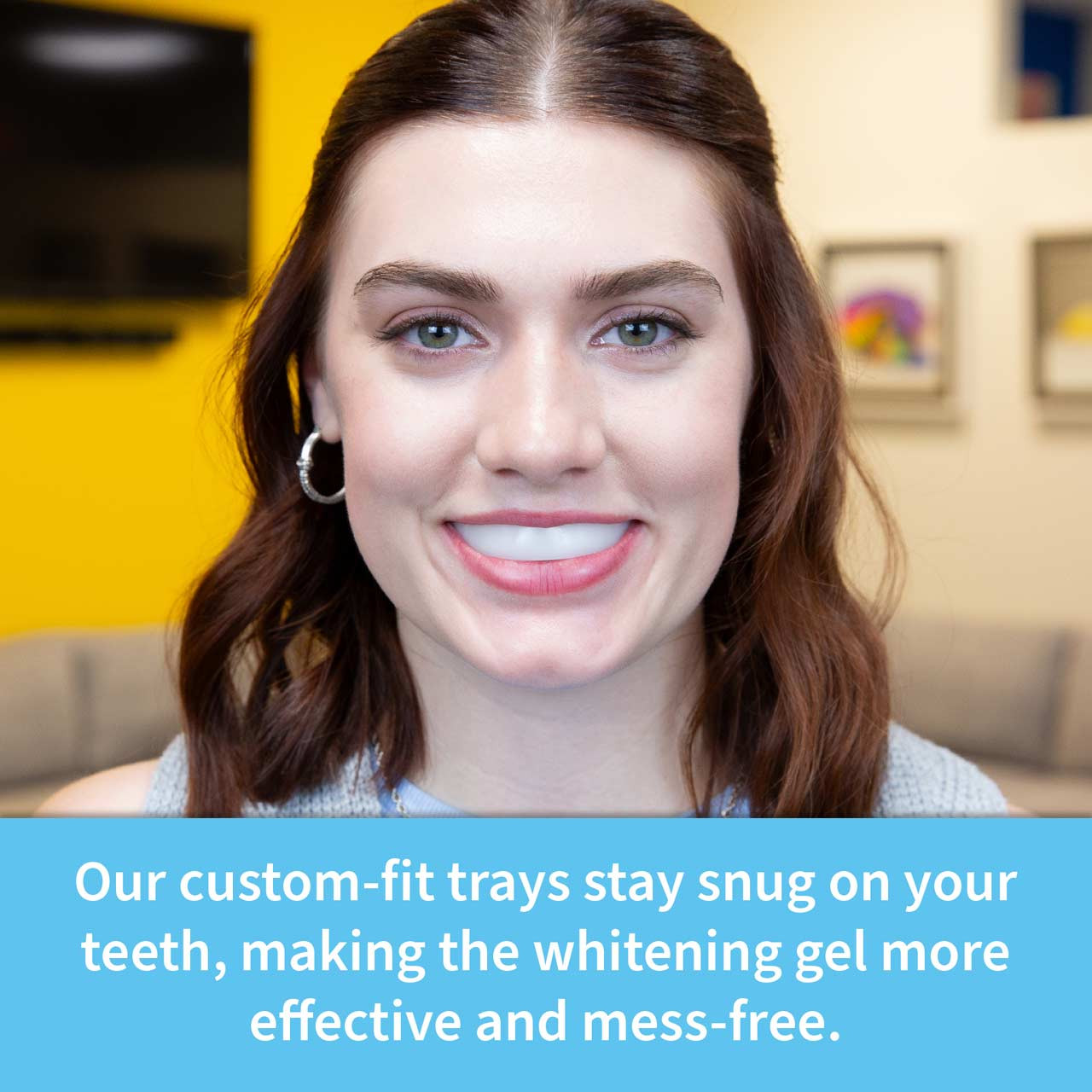 Custom Fit Teeth Whitening Kit | SOVA White