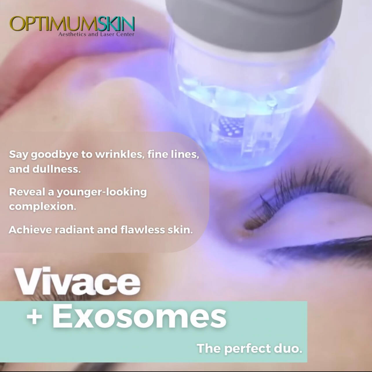 Vivace Microneedling - Optimum Skin