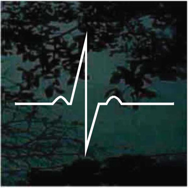 Heartbeat Decals & Stickers for Cars, Trucks, and Windows