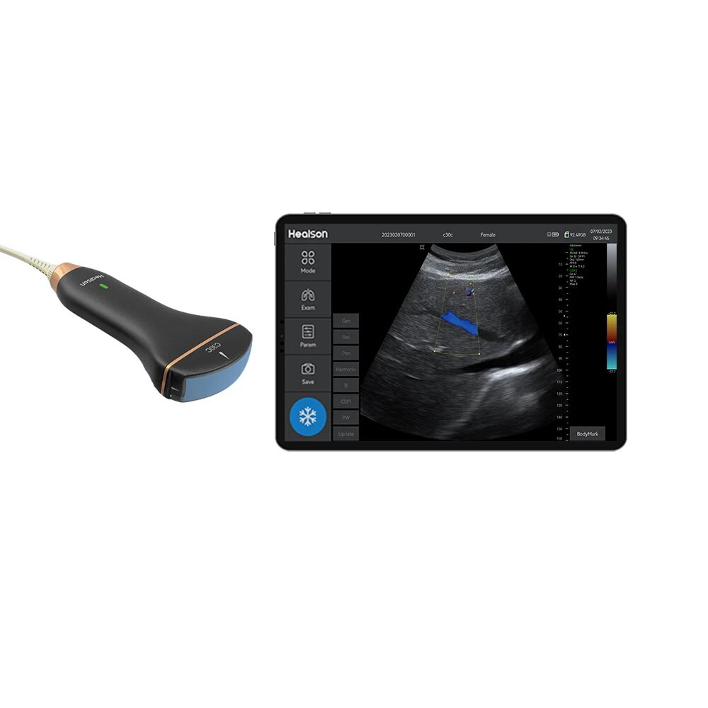Pocket Colour Ultrasound Probe C30C 18 Frames High Speed Clear Image ...