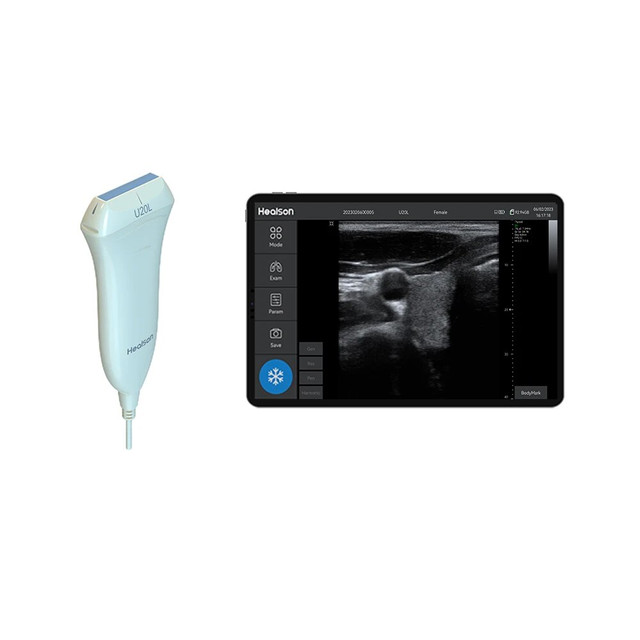 Pocket Colour Ultrasound Probe C30C 18 Frames High Speed Clear Image ...