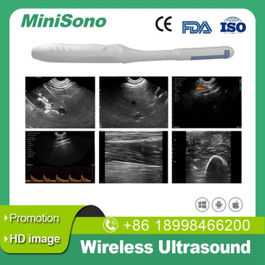 Rectal Color doppler Wireless ultrasound machine - Pet Video Verify ...