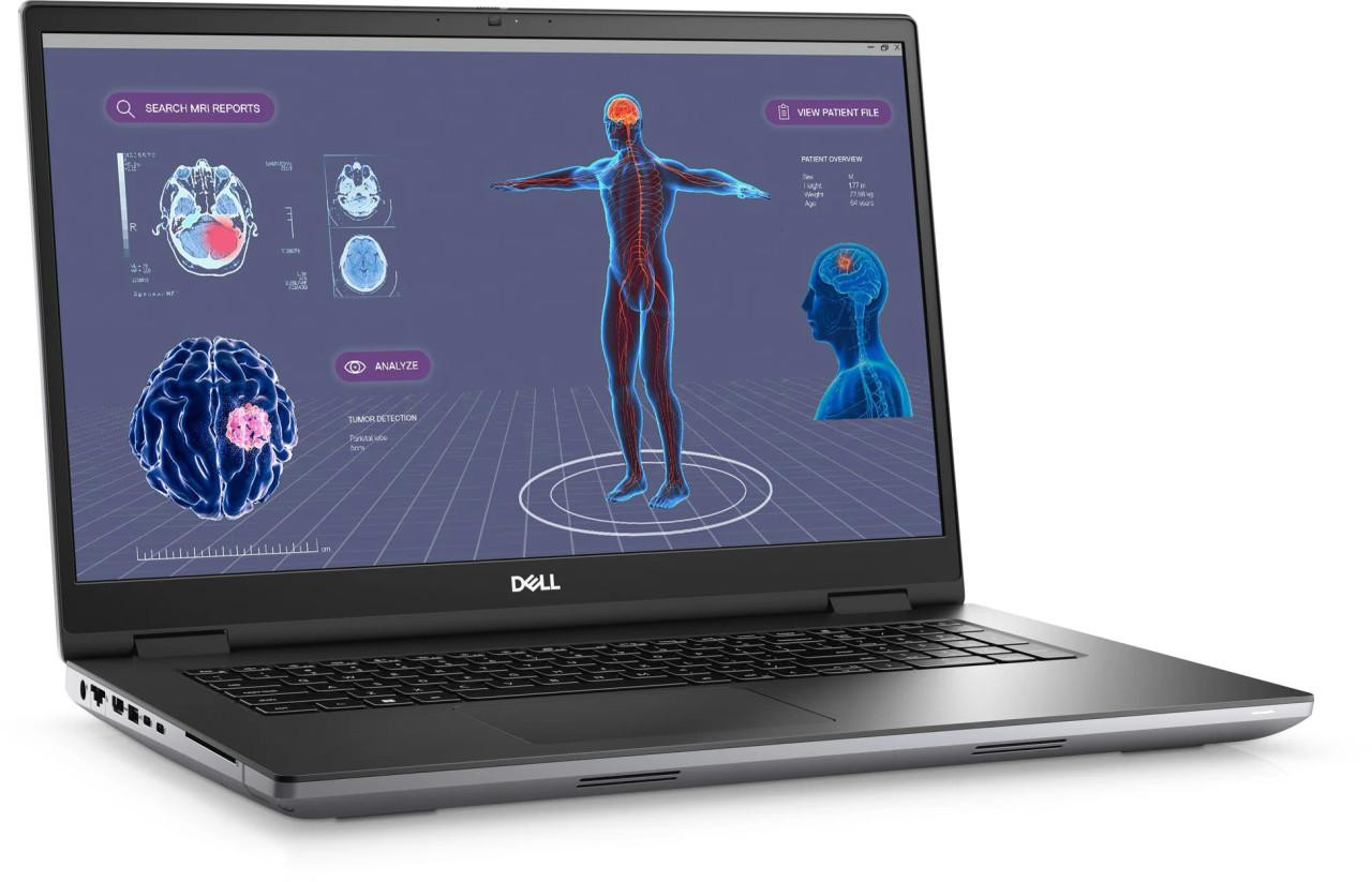 Refurbished 17 Inch Laptops