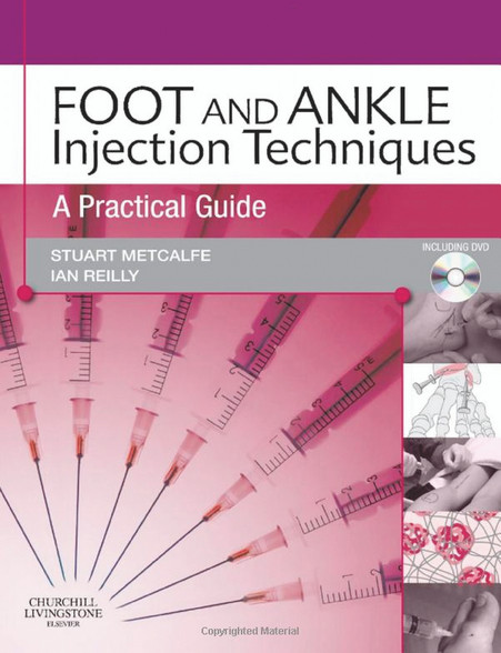 B2312 - FOOT AND ANKLE INJECTION TECHNIQUES, A PRACTICAL GUIDE ...