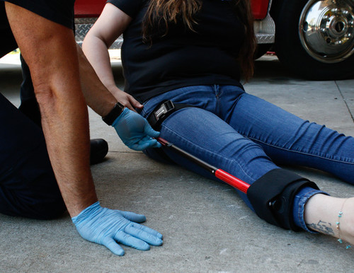 Slishman Traction Splint - Compact (STS-C) | Femoral Splint