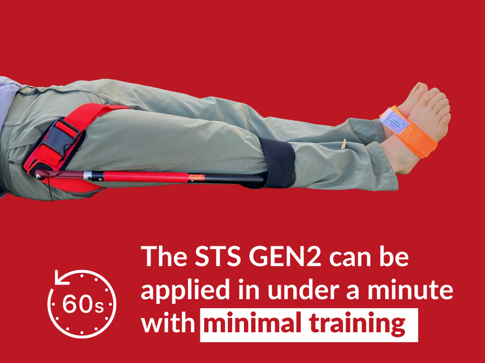 Slishman Traction Splint, Gen 2