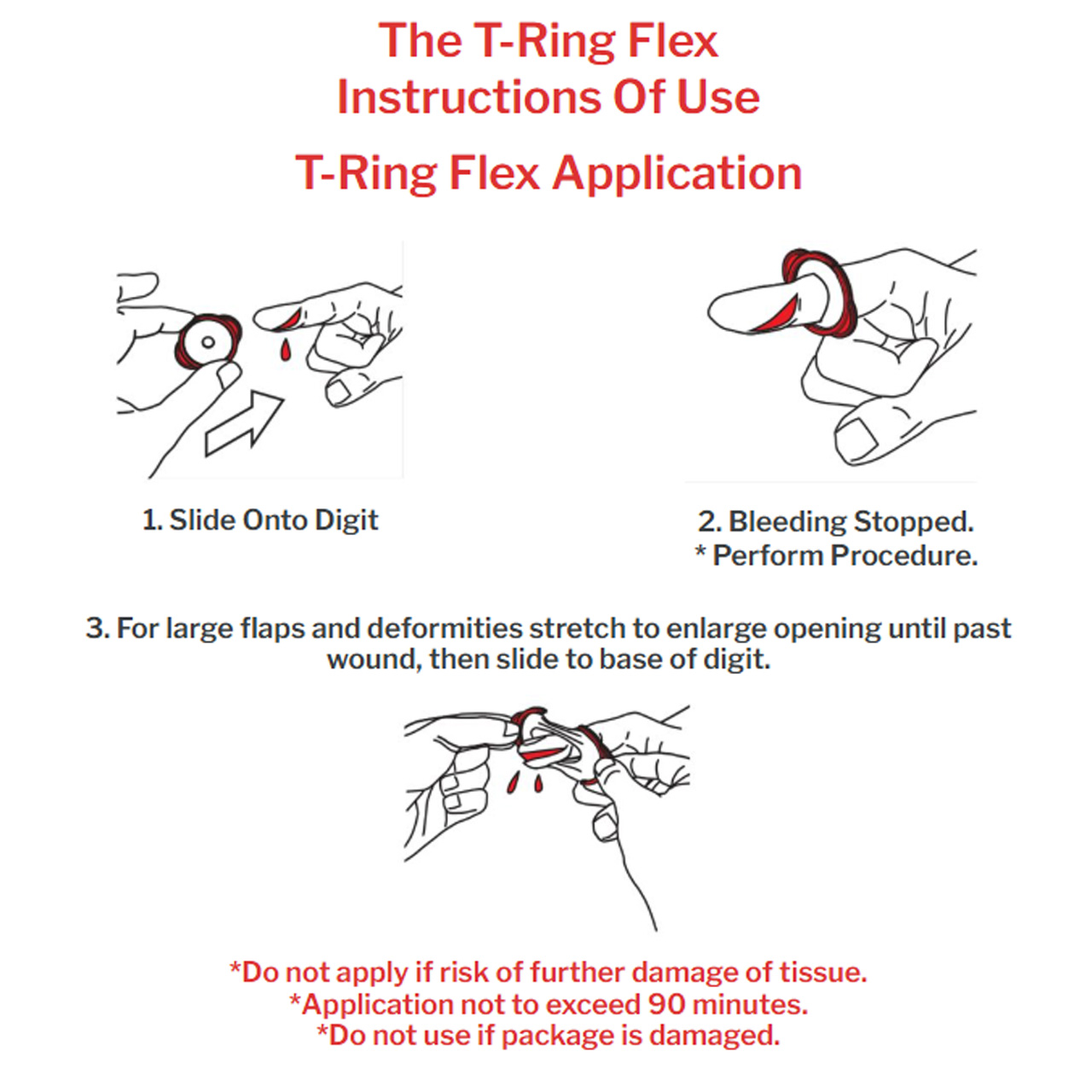 T-Ring Flex