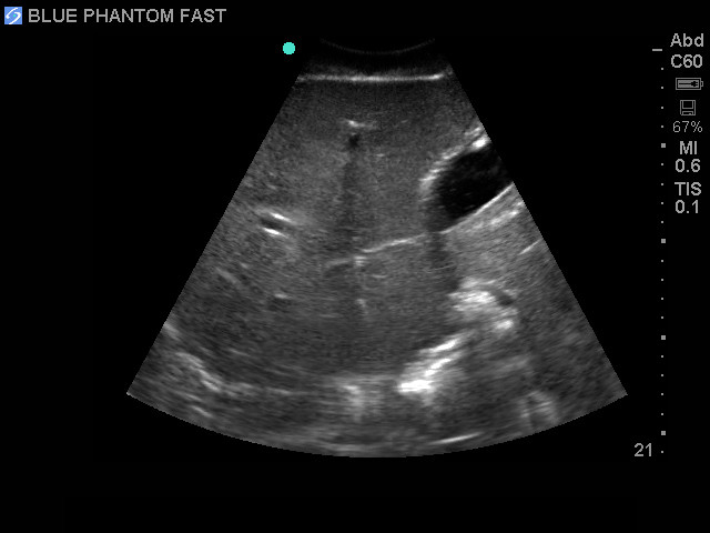 FAST Exam Real Time Ultrasound Training Model - Standard Warranty