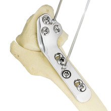 VOI STA-FIX Pin | STA-FIX PIN 0.062