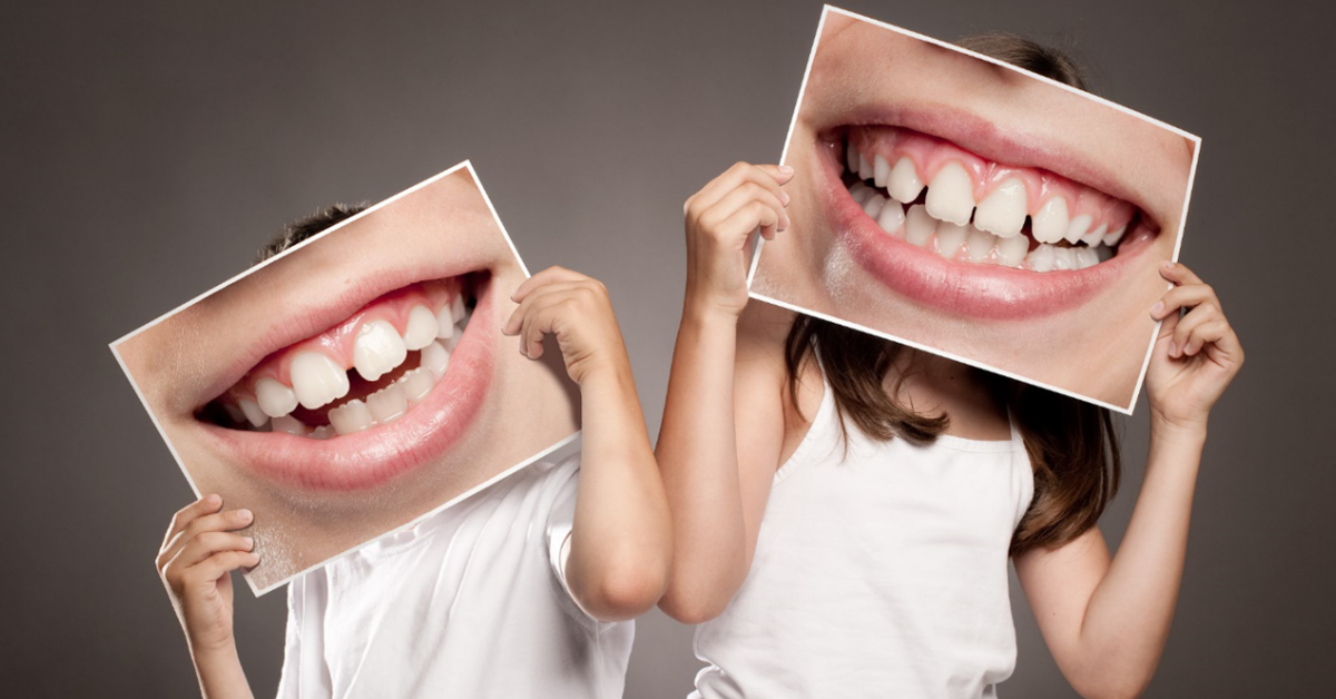 Why Do My Teeth Feel So Fuzzy All The Time? - Epic Dental