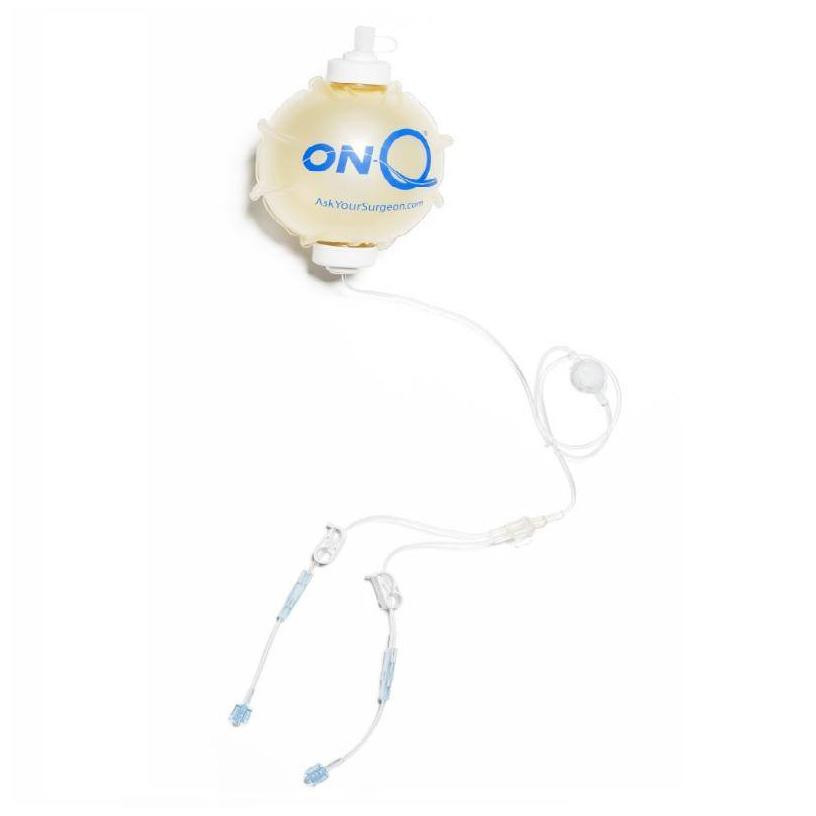 On-Q Fixed Flow Pump System, 400 mL Flow Volume x 10 mL/Hour Flow Rate ...