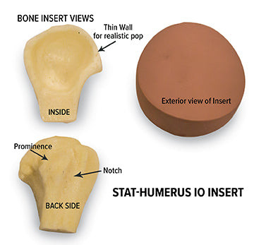 Stat Humerus Intraosseous (IO) Insert, 101-8011 - Medex Supply