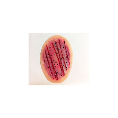Road Rash, Large, 800-654 - Medex Supply