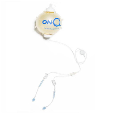 On-Q Fixed Flow Pump System, 400 mL Flow Volume x 5 mL/Hour Flow Rate ...