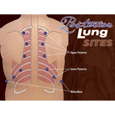 Nasco Posterior Heart and Lung Sites Poster - Medex Supply