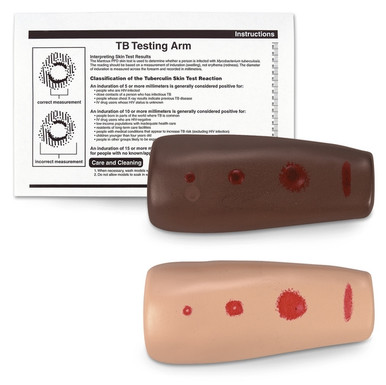 TB Testing Arm - Medex Supply