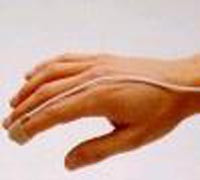 Nellcor Oxisensor II Neonatal/Adult Oxygen Sensor Probe - Medex Supply