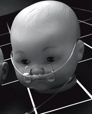 Salter Tender Grip Infant Skin Fixation System, 25/bx - Medex Supply