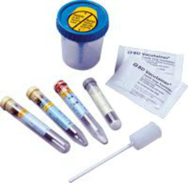 BD Vacutainer Urine Collection Kit with Screw Cap Cup, 16 mm x 100 mm ...