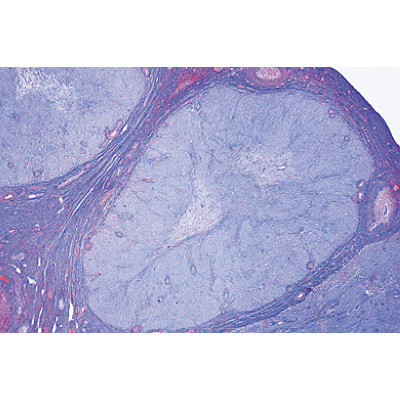 Endocrine System - Slides - EMRN - Equipment Medical Rive Nord