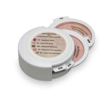 5-Pieced Hinged Skin Cancer Disk Set