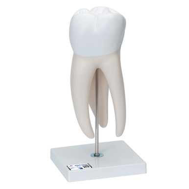 Giant Molar with Dental Cavities Human Tooth Model, 15 times Life-Size, 6 part - 3B Smart ...