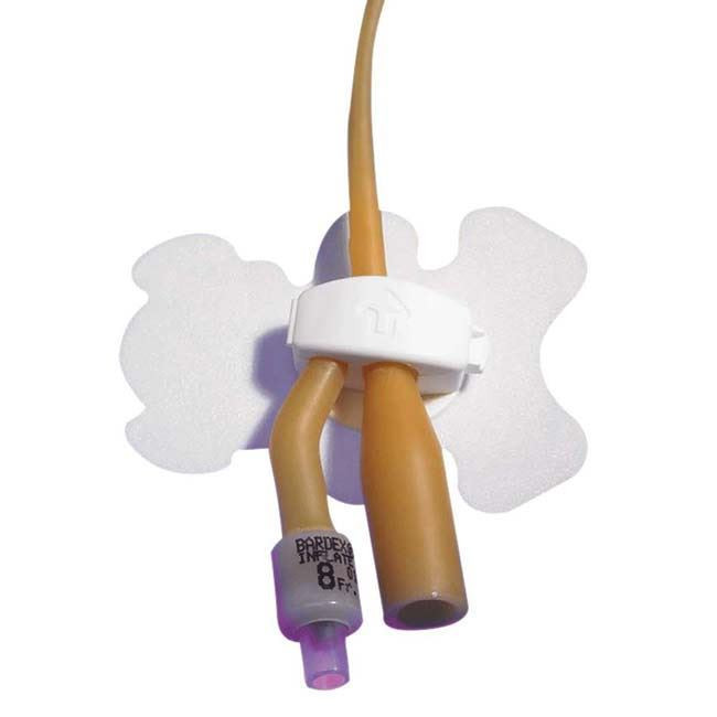 Bard StatLock - Pediatric Foley Stabilization Device