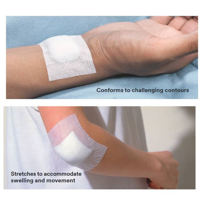 Medical Tape - Surgical and Adhesive Tape for Sale