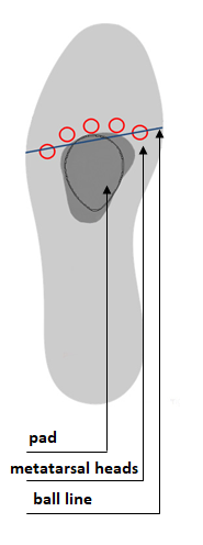 Placement of Metatarsal Pads - Pedag USA