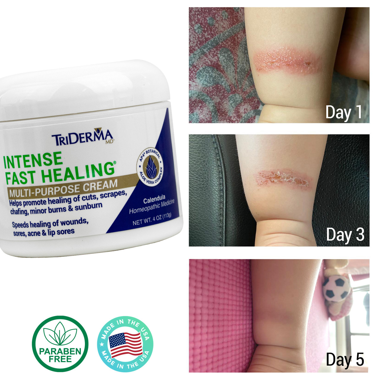 Intense Fast Healing Cream 4.0 oz - 4pk