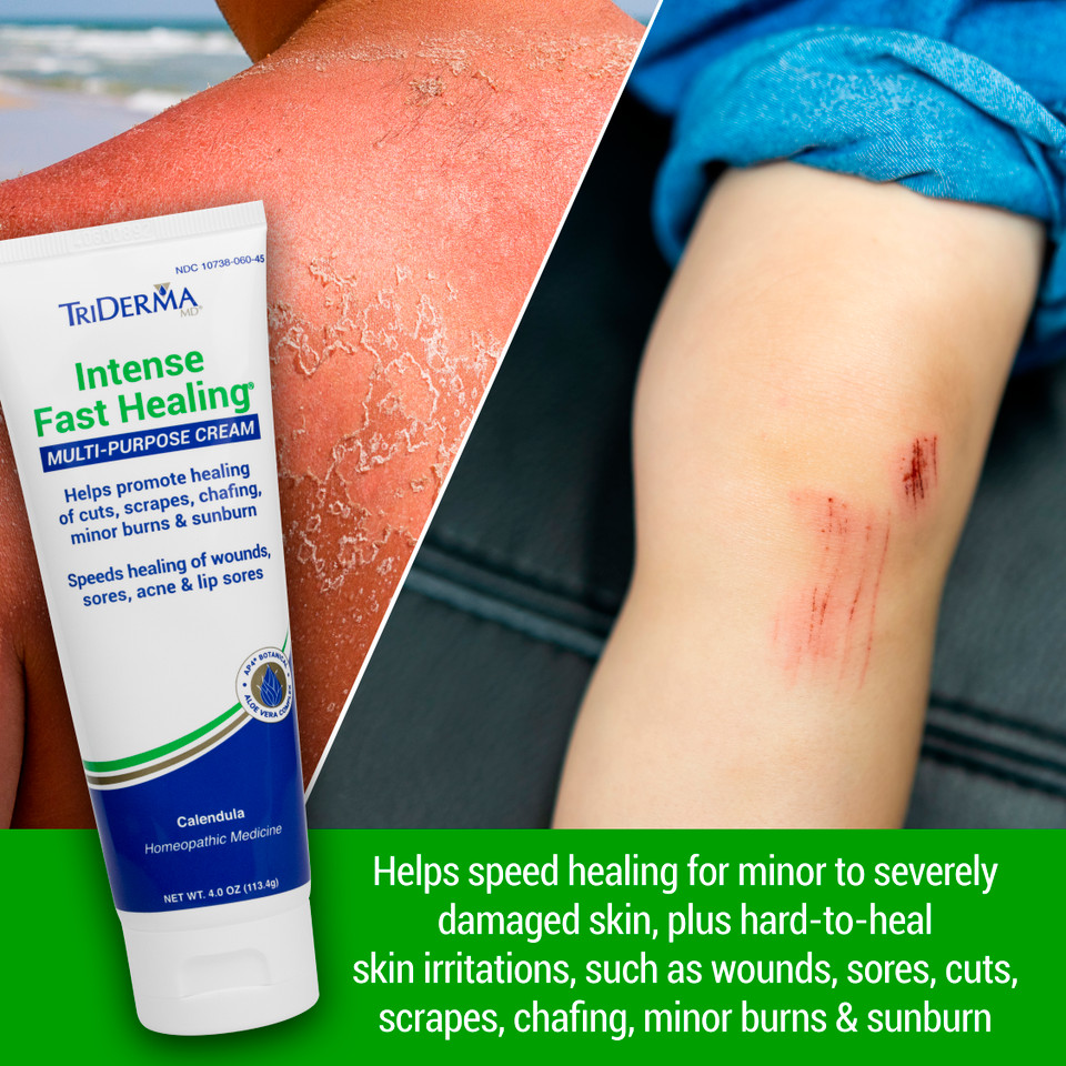 Intense Fast Healing Cream (Multiple Sizes)
