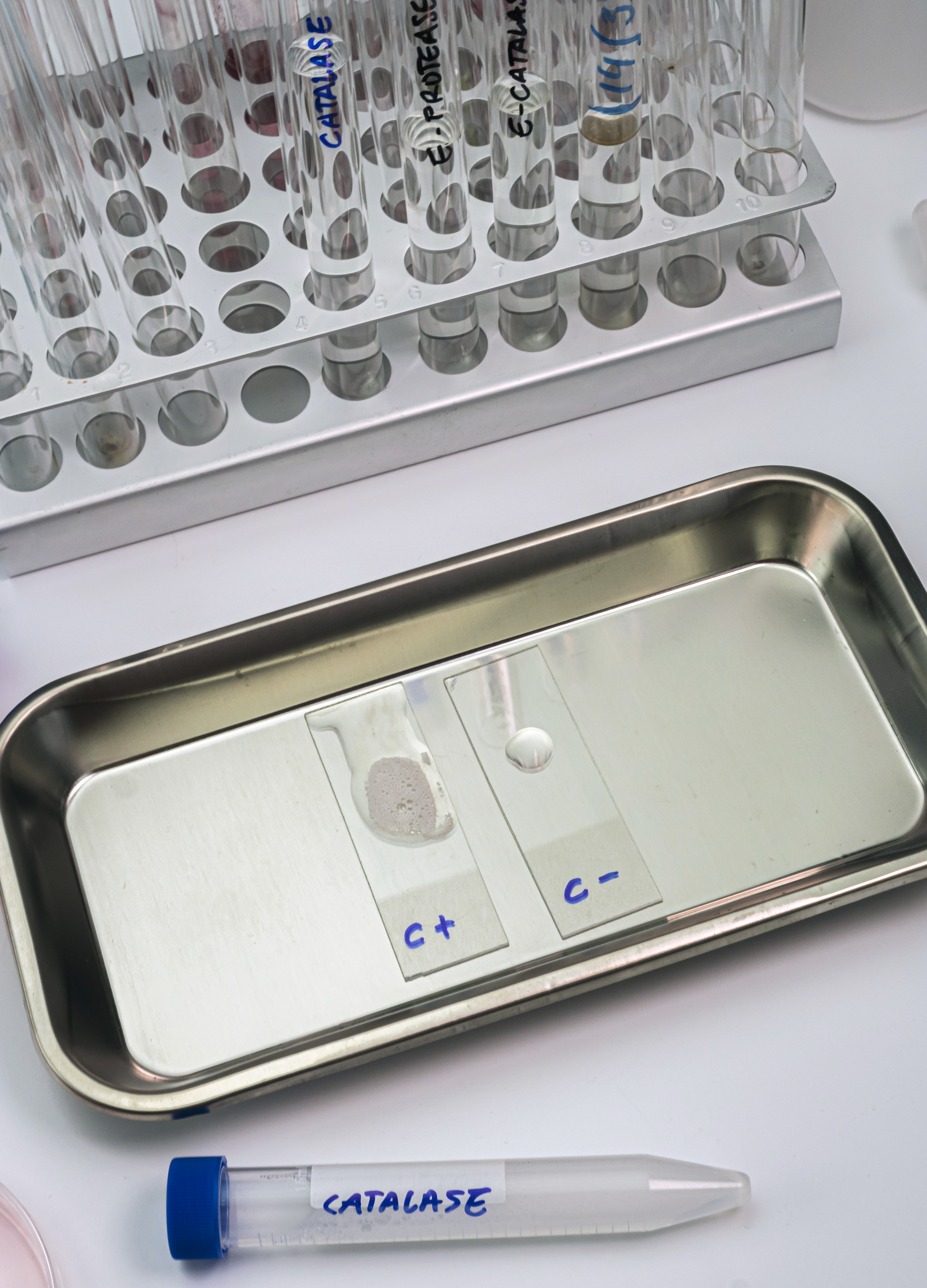 Catalase: The Bodyguard Against Fizz and Fury - How It Protects Your ...