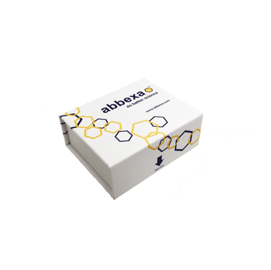 SARS-CoV Spike Protein | abx060655 | abbexa