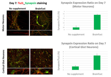 BrainFast Neuronal Maturation Supplement | BX-2000