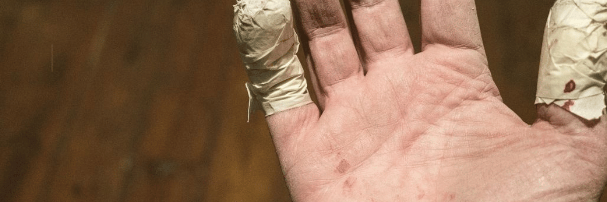 The 3 Most Common Types of Hand Injuries in the Workplace (and How to ...