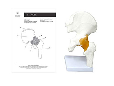 Hip Joint Anatomical Cast Scientific Model by Trademark Scientific ...