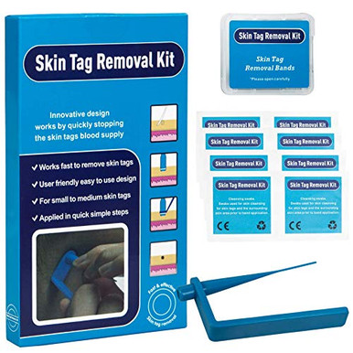 Skin Tag Remover Kit Skin Tag Removal Device for Small to Medium Moles ...