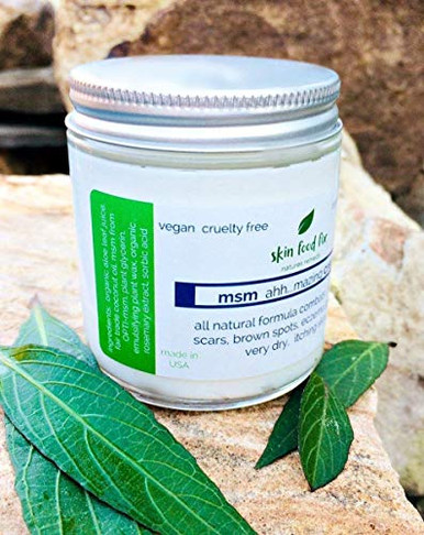 MSM Cream Rosacea Eczema Psoriasis Scars - Warehousesoverstock