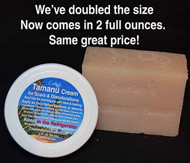 Carley s Tamanu Cream for Scars and Discolorations - Warehousesoverstock