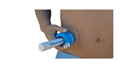 SECURPRESS Stoma Secure Device - 1-Pack - 1 7 8 inch for Any Type of ...