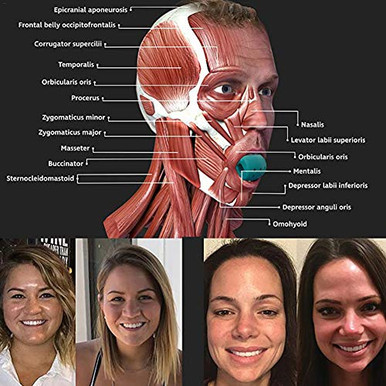 Facial Jaw Exerciser Facial Muscle Exerciser Face-Lift Artifact Chew ...