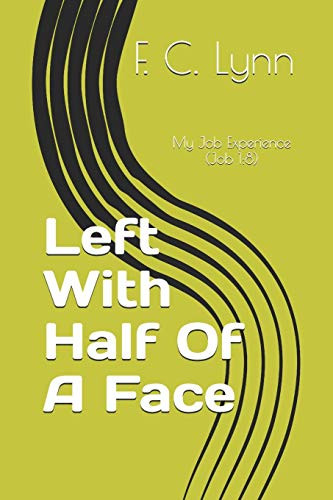 Left With Half Of A Face- My Job Experience - Warehousesoverstock