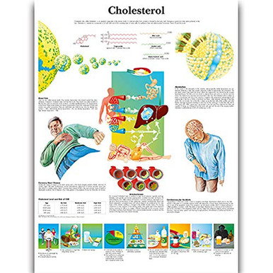 Cholesterol Anatomy Posters for Walls Nursing Students Educational ...