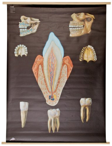 3B Scientific V2016U Healthy Denture Anatomical Chart- without Wooden ...