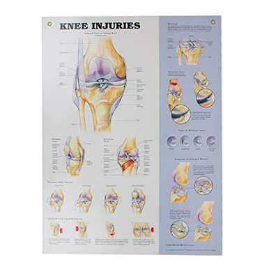Wolters Kluwer Health Anatomical Chart Series- Knee Injuries Chart ...